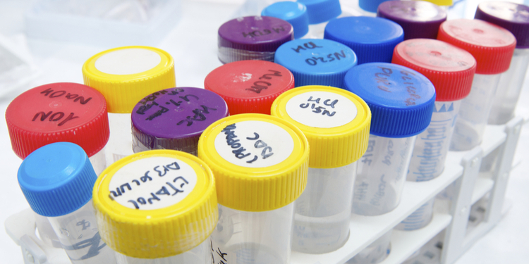 New IVD regulation is coming. are you ready?